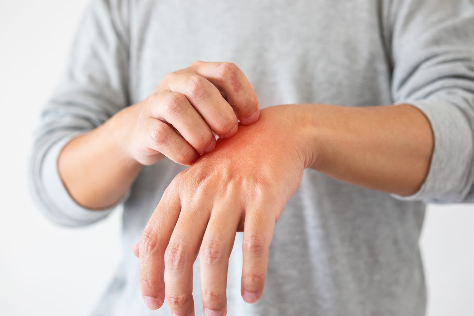 SKIN DISORDERS - Vail | Aspen | Basalt | Glenwood Dermatology